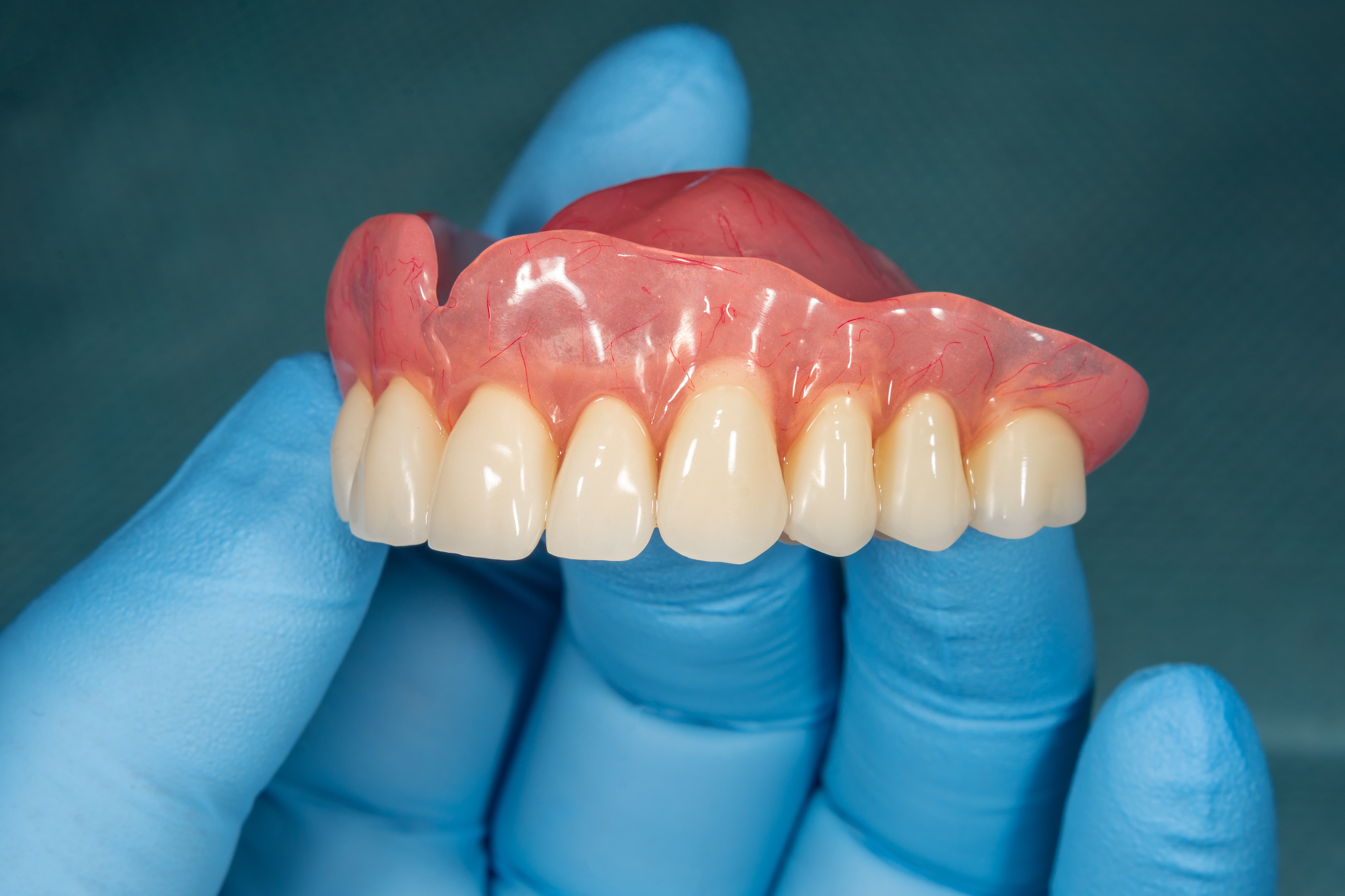 Can Dentures Rebuild Your Smile Springfield OH Can Dentures Rebuild Your Smile Springfield OH