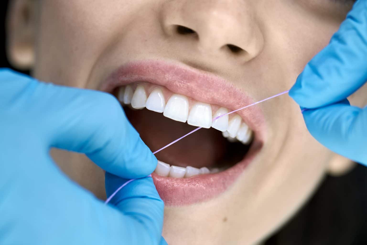 Dental Cleaning Tailored To Your Teeth Springfield OH dental-cleaning-tailored-to-your-teeth-springfield-oh
